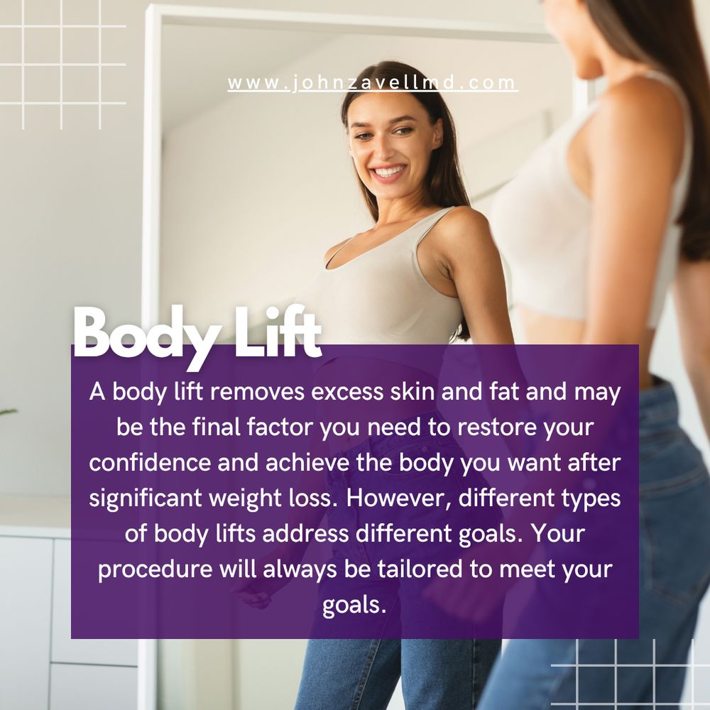 JOHN F. ZAVELL, MD, FACS - Updated August 2025 - 64 Photos - 2865 N ...