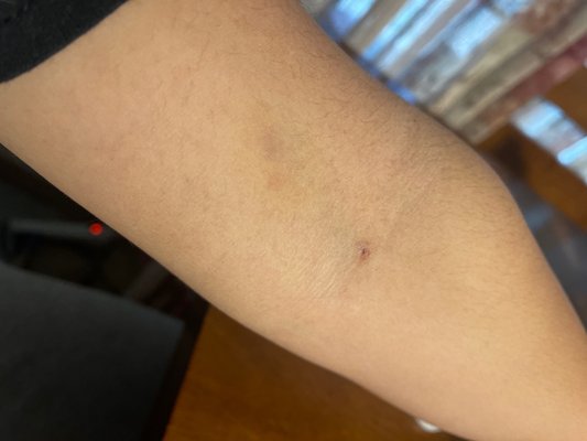 BIOLIFE PLASMA SERVICES - Updated August 2025 - 61 Photos & 240 Reviews ...