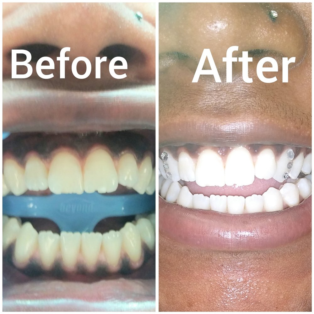 GLEAMING SMILES - 23000 Greenfield Rd, Oak Park, Michigan - Teeth ...