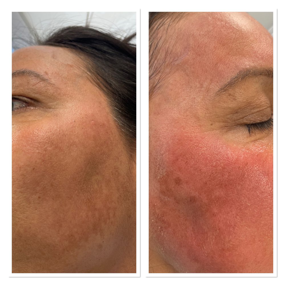 COSMETIC NURSE INJECTOR - Updated July 2025 - Request an Appointment ...