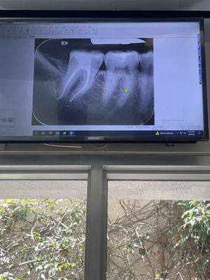 ROOTVISION ENDO - Updated January 2026 - 54 Photos & 212 Reviews - 3663 ...