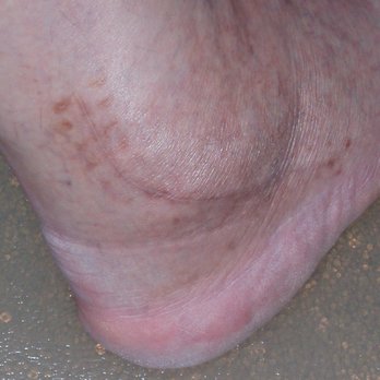 TRIAD FOOT & ANKLE CENTER - Updated September 2025 - 10 Reviews - 1680 ...