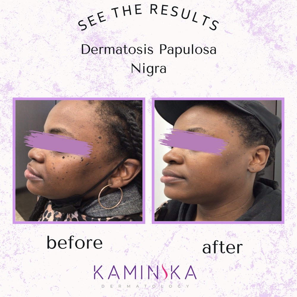 KAMINSKA DERMATOLOGY - Updated December 2025 - 17 Photos & 51 Reviews ...