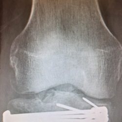 JUSTIN CHRONISTER, MD - 62 Photos - 1431 Studemont St, Houston, TX - Yelp