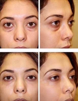 JIMMY S. FIROUZ, MD, FACS - 167 Photos & 367 Reviews - 416 N Bedford Dr ...