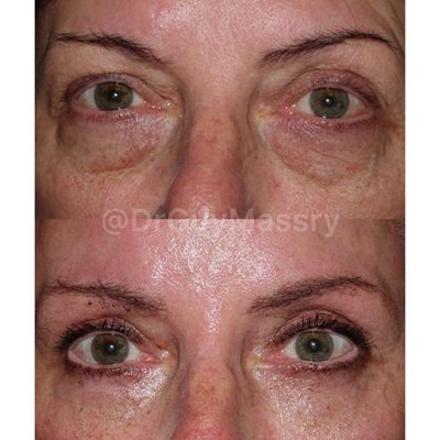 GUY MASSRY, MD - Updated June 2024 - 148 Photos & 136 Reviews - 150 N ...