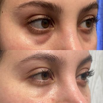 MEHRYAR RAY TABAN MD - OCULOPLASTIC SURGEON - Updated January 2025 ...