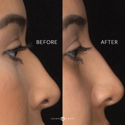 JASON EMER, MD - 995 Photos & 384 Reviews - 9201 Sunset Blvd, West ...