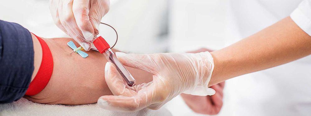 BUTTERFLY STICK MOBILE PHLEBOTOMY - Updated June 2026 - Sacramento ...