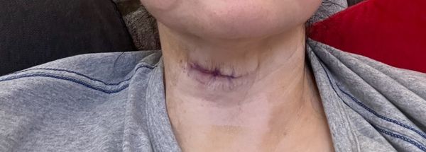 GORDON TANG, MD - EAST BAY NEUROSURGERY & SPINE - Updated December 2025 ...