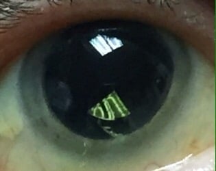 FROMER EYE CENTERS - Updated December 2025 - 14 Photos & 66 Reviews ...