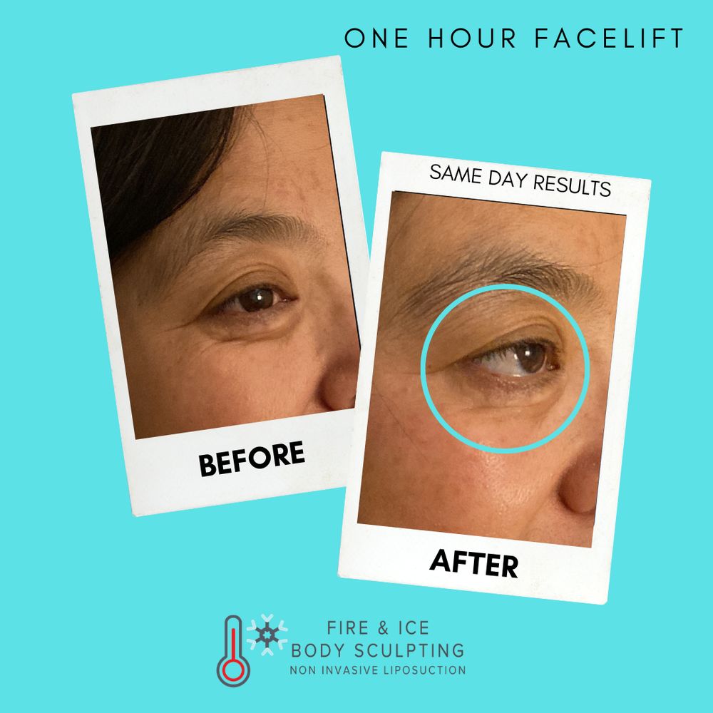 FIRE & ICE BODY SCULPTING - Updated May 2025 - 6330 Falls Of Neuse Rd ...