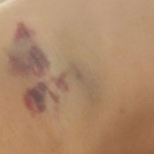 UHS VESTAL WALK IN - Updated December 2025 - 4417 Vestal Pkwy E, Vestal ...