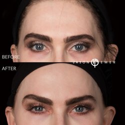 JASON EMER, MD - 929 Photos & 387 Reviews - 9201 Sunset Blvd, West ...