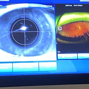 MCMINNVILLE EYE CLINIC - Updated July 2025 - 19 Reviews - 2445 NE ...