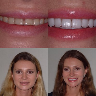 MITCHELL A POHL, DDS - Updated September 2025 - 81 Photos & 21 Reviews ...