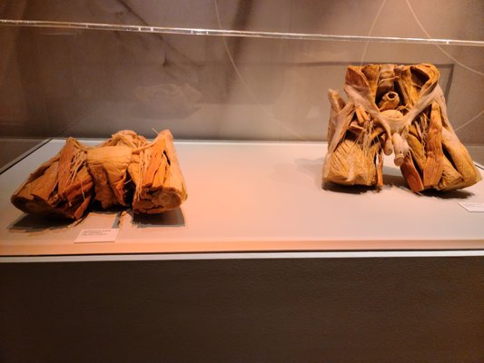 BODIES... THE EXHIBITION - Updated November 2024 - 340 Photos & 425 ...