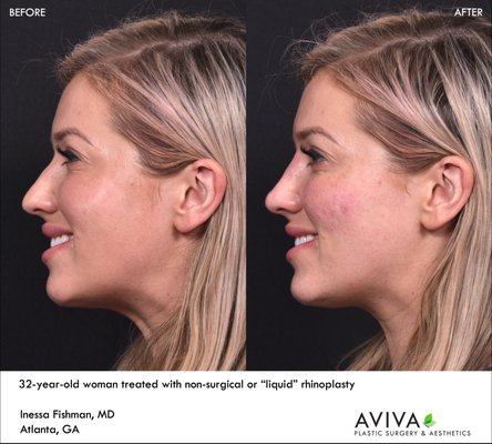 AVIVA PLASTIC SURGERY & AESTHETICS - Updated August 2025 - 456 Photos ...