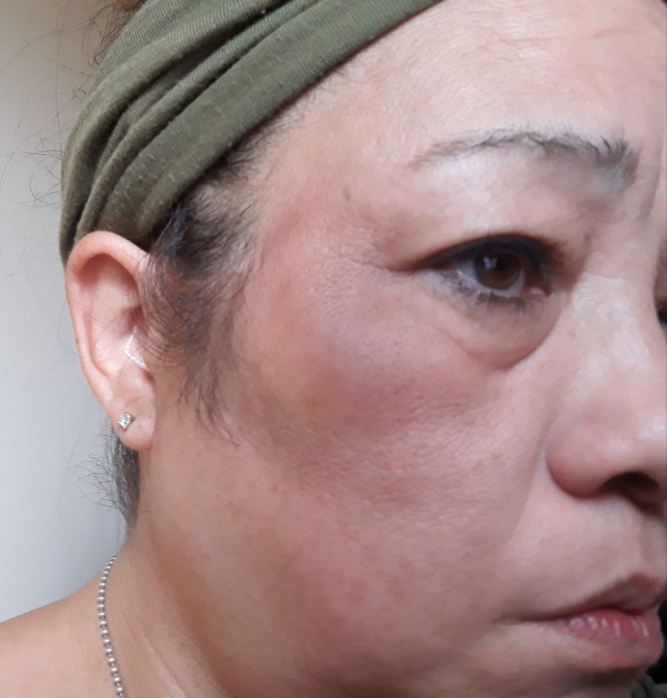 RON BELL INJURY LAWYERS - Updated October 2025 - 10 Photos - 7309 ...