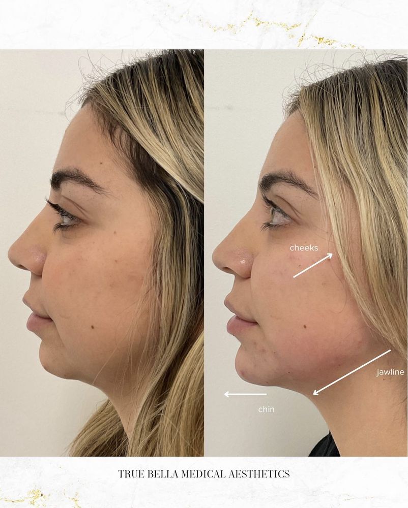 TRUE BELLA MEDICAL AESTHETICS - Updated March 2025 - 303 Photos & 178 ...