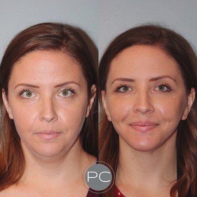 PACIFIC CENTER FOR PLASTIC SURGERY - Updated January 2025 - 114 Photos ...