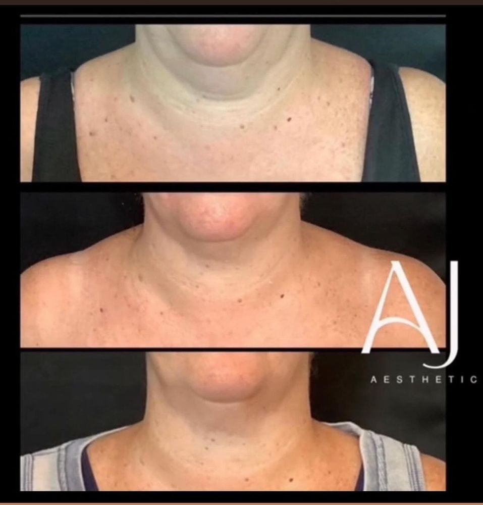 ANNE JUDGE AESTHETICS - Updated December 2025 - 11 Photos - 3838 ...