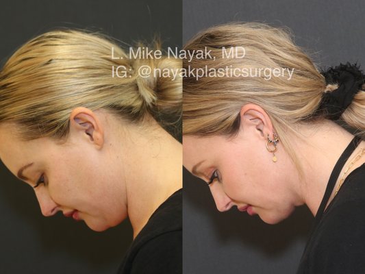 NAYAK PLASTIC SURGERY - Updated March 2025 - 266 Photos & 33 Reviews ...