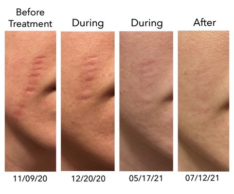 SCAR HEALING INSTITUTE - Updated December 2025 - 30 Photos & 62 Reviews ...