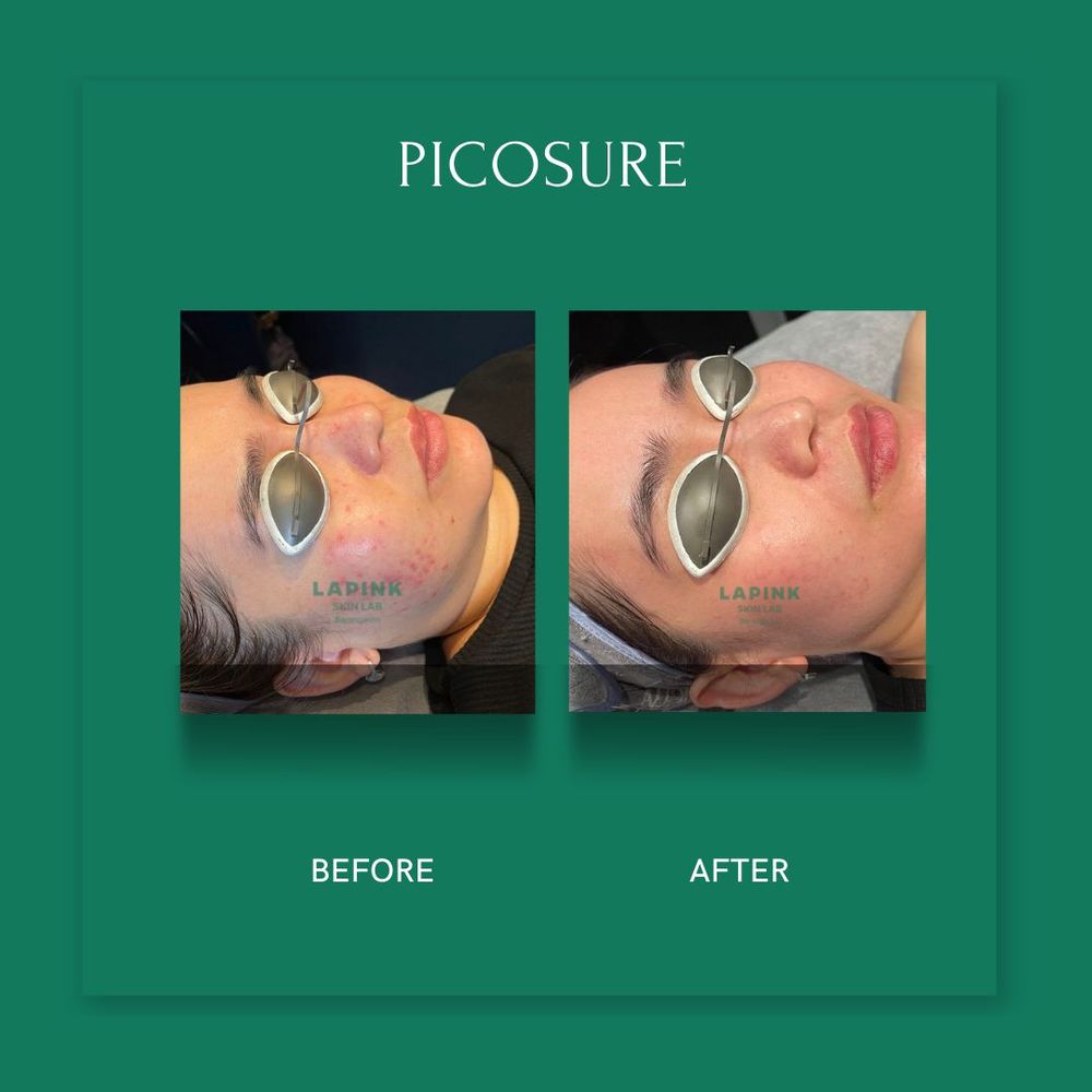 LAPINK SKIN LAB - Updated November 2024 - 26 Lime St, Barangaroo New ...