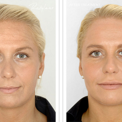 TAL DAGAN, MD, FACS - 22 Photos & 73 Reviews - 420 Madison Ave, New ...