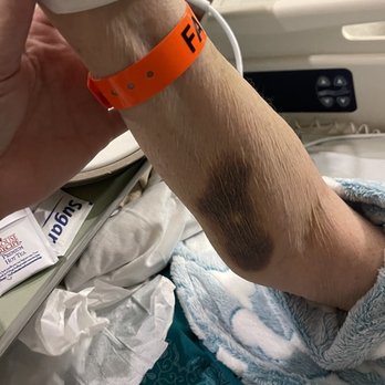 ENCOMPASS HEALTH REHABILITATION HOSPITAL OF ALTAMONTE SPRINGS - Updated ...