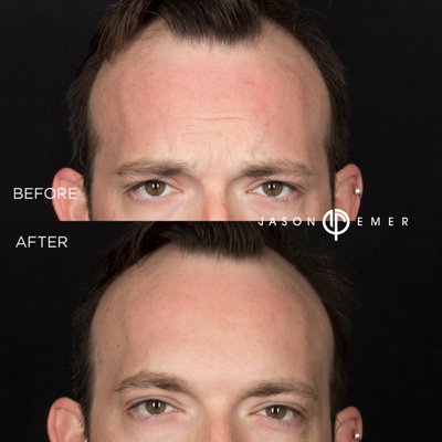 JASON EMER, MD - 1011 Photos & 427 Reviews - 9201 Sunset Blvd, West ...