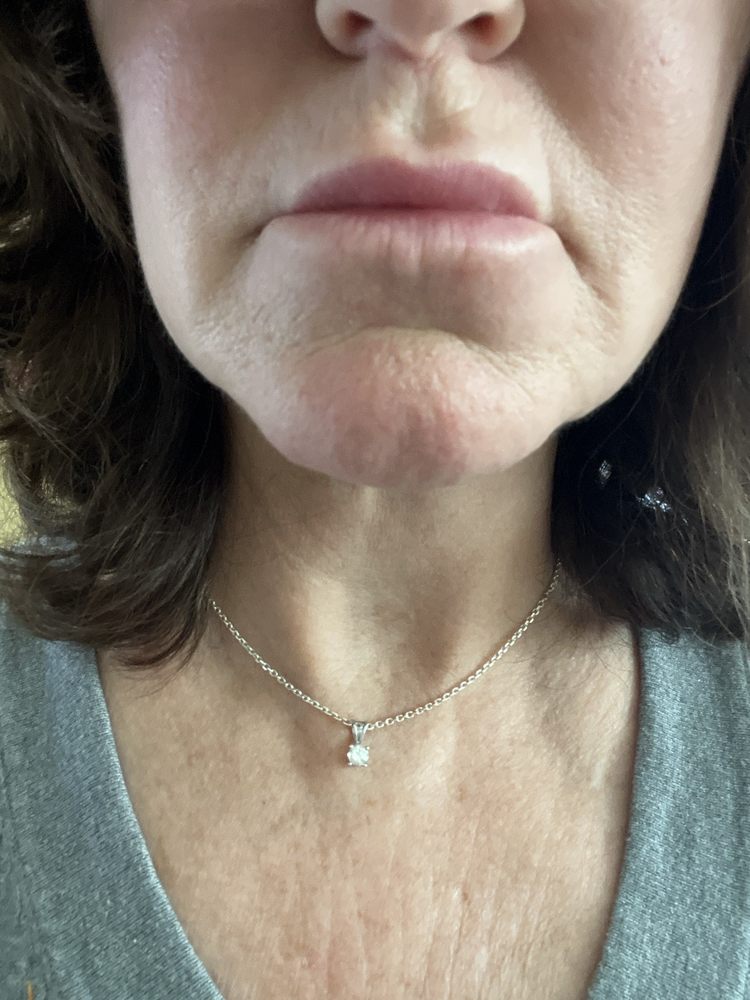 DOUGLAS SUNDE, M.D., F.A.C.S. - Updated November 2025 - 15 Reviews ...