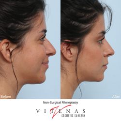 VITENAS COSMETIC SURGERY - 177 Photos & 66 Reviews - 4208 Richmond Ave ...