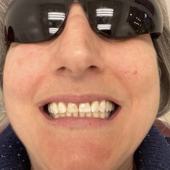 FULLER SMILES - HUNTINGTON PARK - Updated January 2026 - 35 Photos & 31 ...