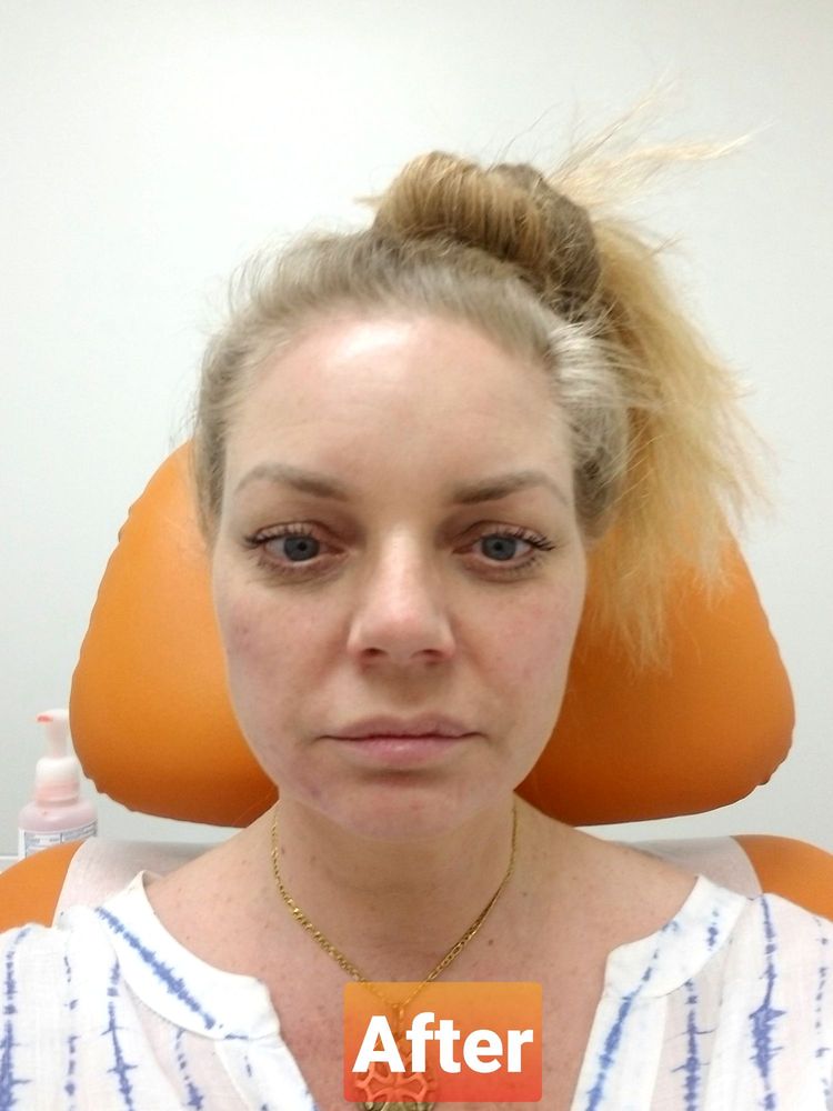 AVA KHOSRAVIANI, MD, FAAD - SKINWELL DERMATOLOGY - Updated December ...