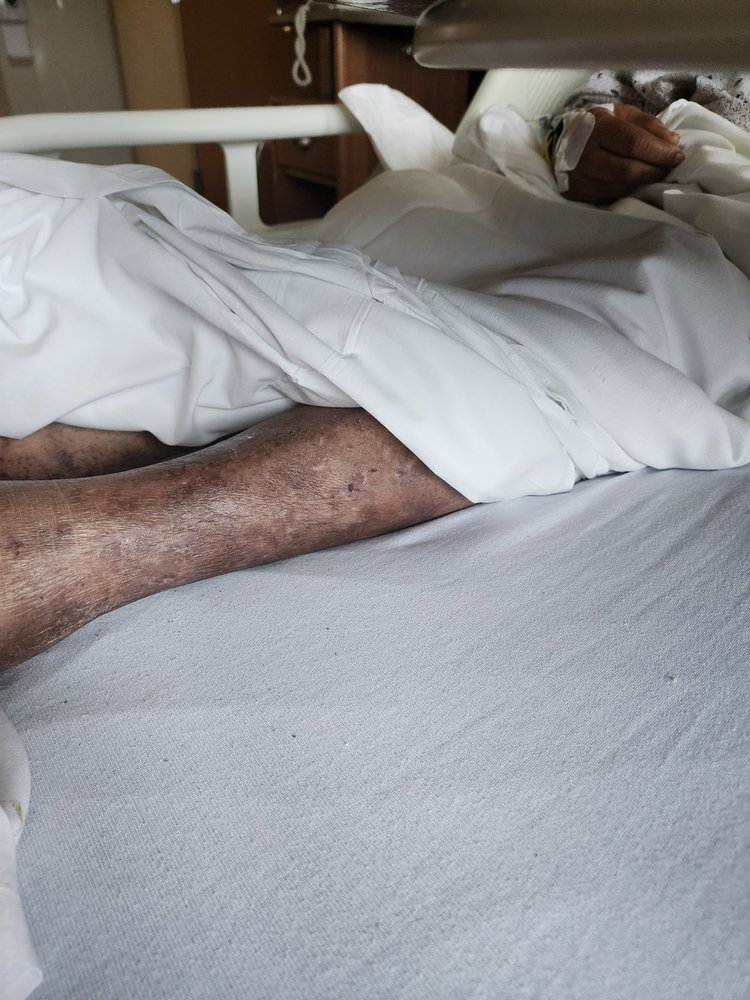 HAMILTON CONTINUING CARE CENTER - Updated December 2025 - 13 Reviews ...