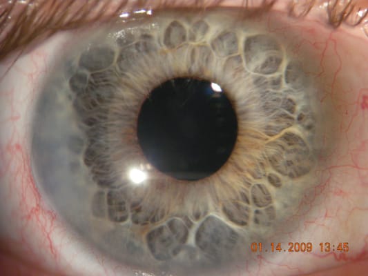 UDAY DEVGAN, MD - Updated October 2025 - 15 Photos & 160 Reviews ...