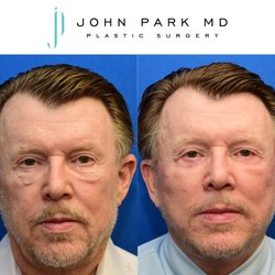 JOHN PARK MD PLASTIC SURGERY - 94 Photos & 74 Reviews - 180 Newport ...