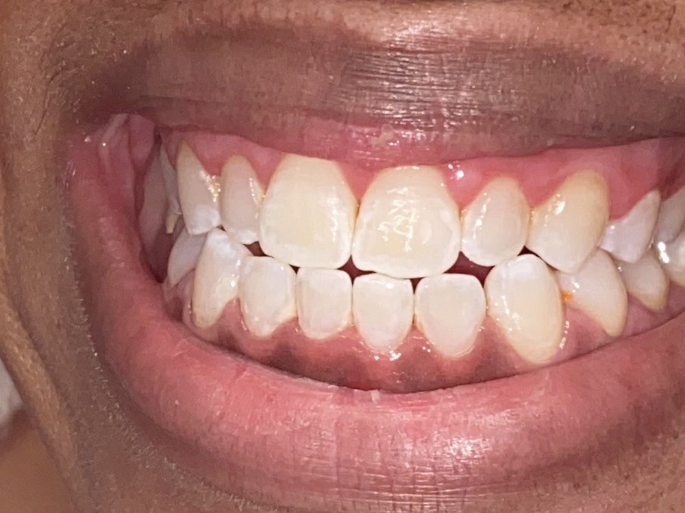 CIERA WHITE SMILE BAR - Updated January 2026 - 11 Photos - Baltimore ...