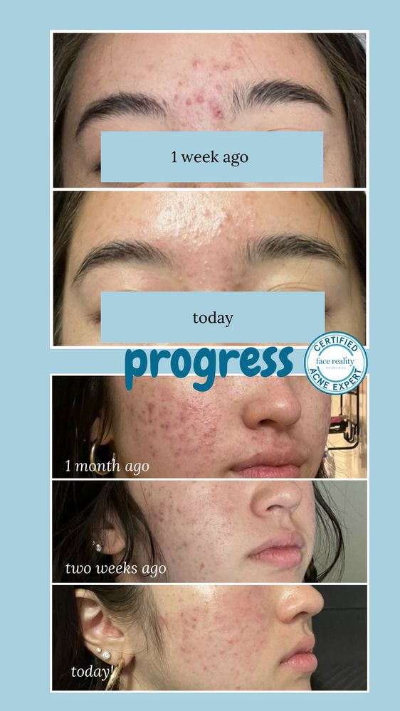 SKIN AND BROW BAR - Updated July 2025 - 10 Photos - 4225 Glass Rd NE, Cedar Rapids, Iowa - Skin ...