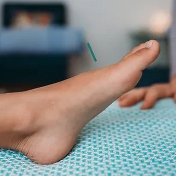 TCM ACUPUNCTURE - CORAL GABLES - Updated January 2026 - 17 Photos - 475 ...