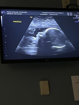 ATRIUM HEALTH - CABARRUS - Updated July 2025 - 57 Photos & 71 Reviews ...