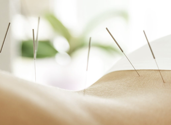 CAROL GOLDMAN ACUPUNCTURE - Updated June 2025 - 104 1/2 Forrest Ave ...