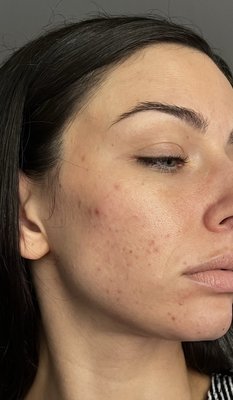 SCOTT C RACKETT, MD - MANHATTAN BEACH DERMATOLOGY - Updated November ...