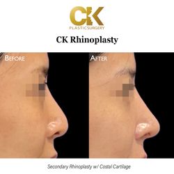 CK PLASTIC SURGERY - 209 Photos & 102 Reviews - 2970 W Olympic Blvd ...