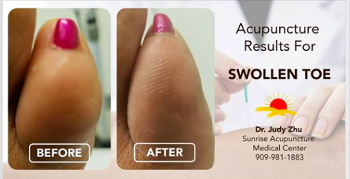 SUNRISE ACUPUNCTURE MEDICAL CENTER - Updated October 2025 - 11 Photos ...