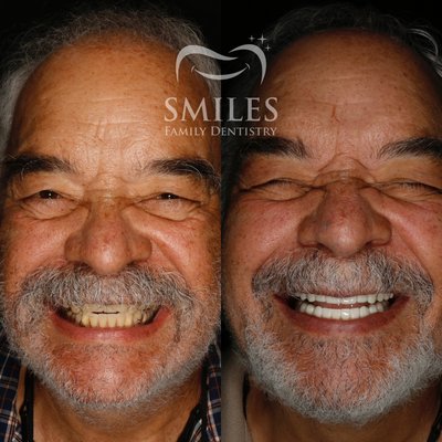 PROMENADE SMILES FAMILY DENTISTRY - Updated July 2024 - 45 Photos - 315 ...