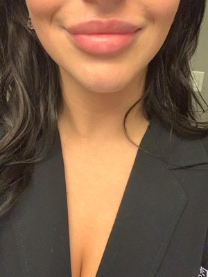 ALLURE ESTHETIC - Updated September 2024 - 59 Photos & 131 Reviews ...