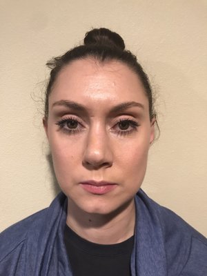 DRMICHAELKIM FACIAL PLASTIC SURGERY - Updated January 2026 - 45 Photos ...